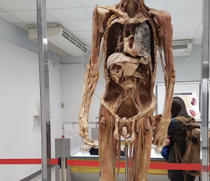 Taxidermy Human Body